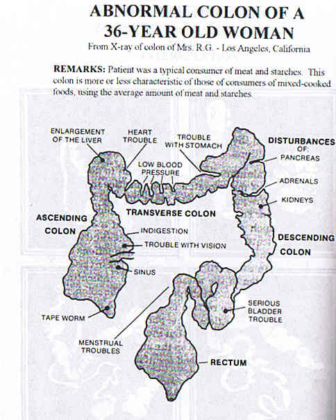 Death and Life Begin in the Colo